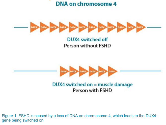 Facioscapulohumeral muscular dystrophy (FSHD) - Muscular Dystrophy UK