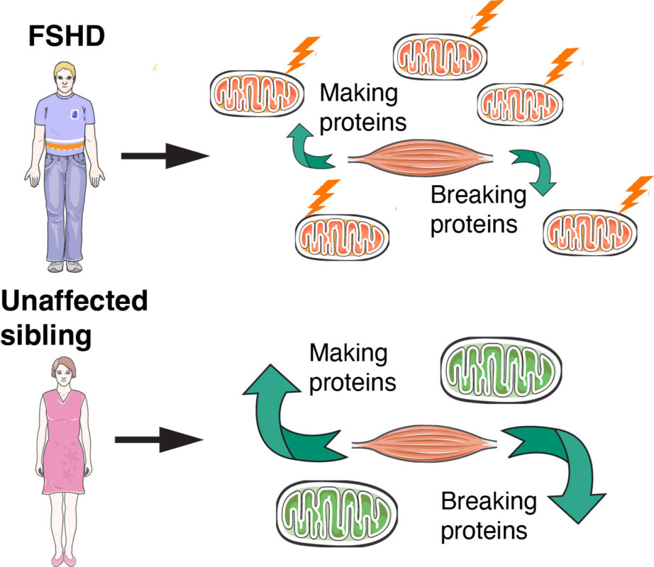Research discovers new insights into the potential cause of ...