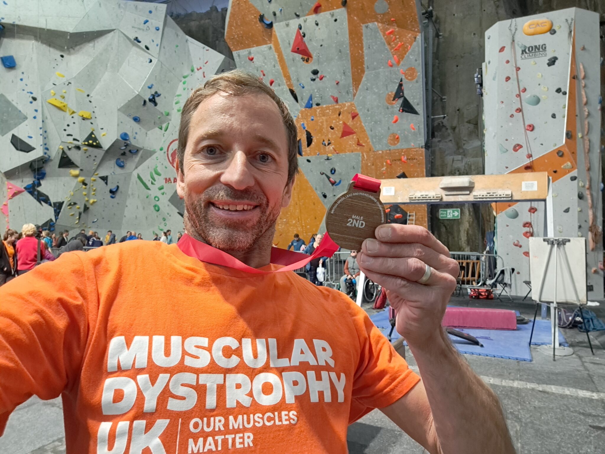 Facioscapulohumeral muscular dystrophy (FSHD) - Muscular Dystrophy UK