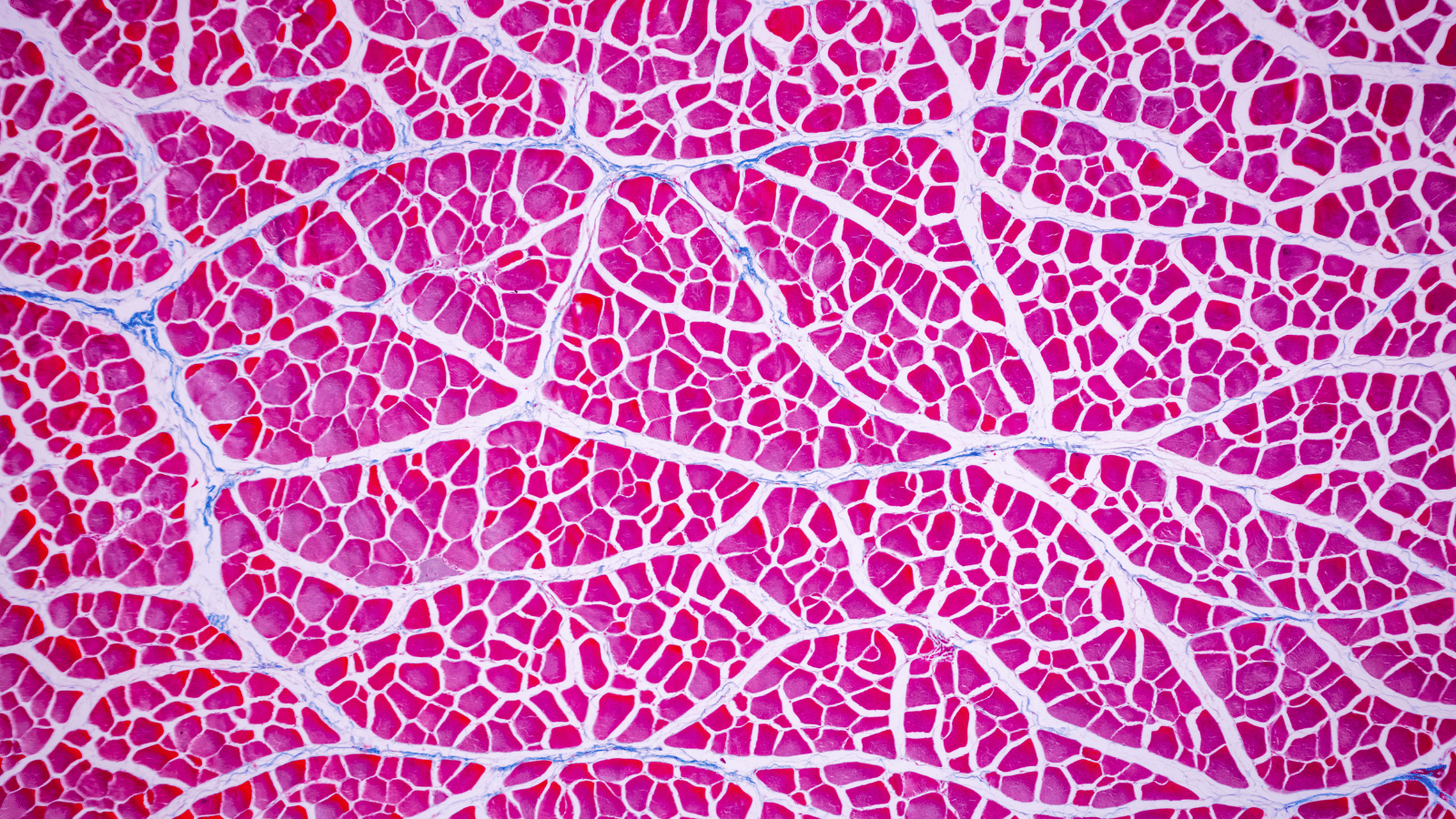 Potential treatment aims to help muscles repair in people with DMD ...